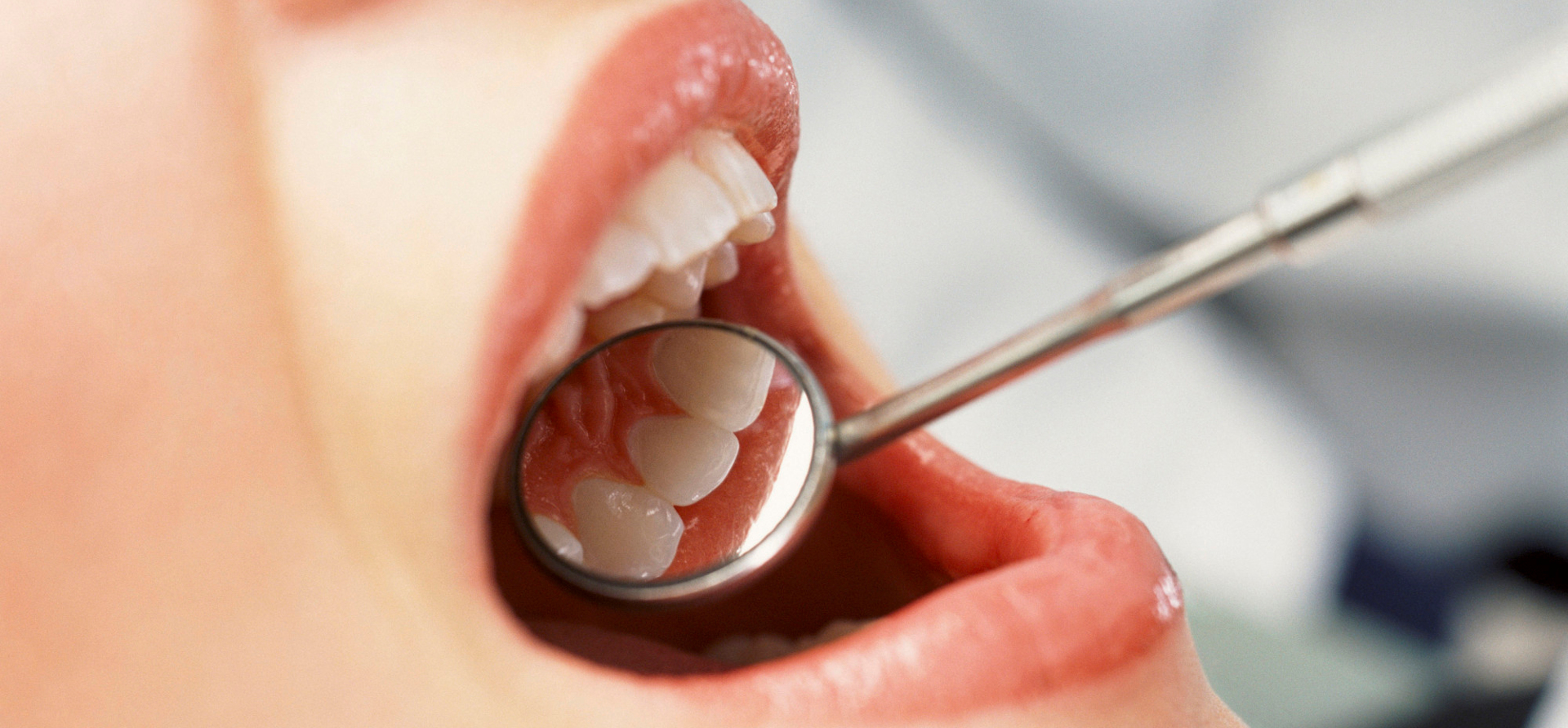 Patient Cabinet Dentaire - Cabinet Dentaire du Chenois